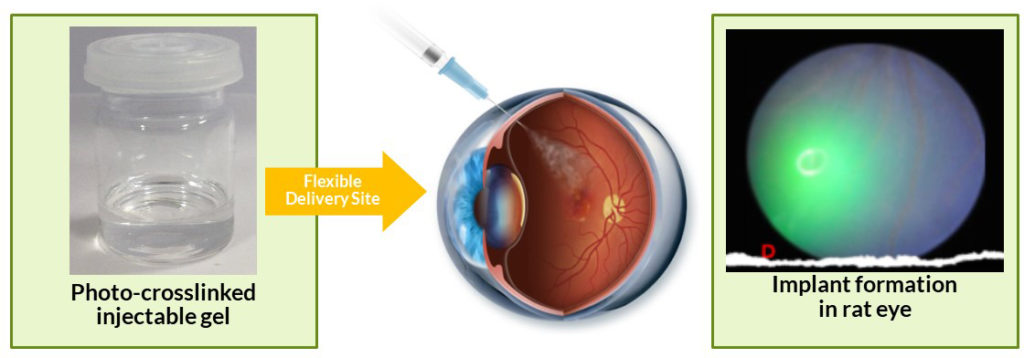 OcuLief™ - Re-Vana: Vision In The Future